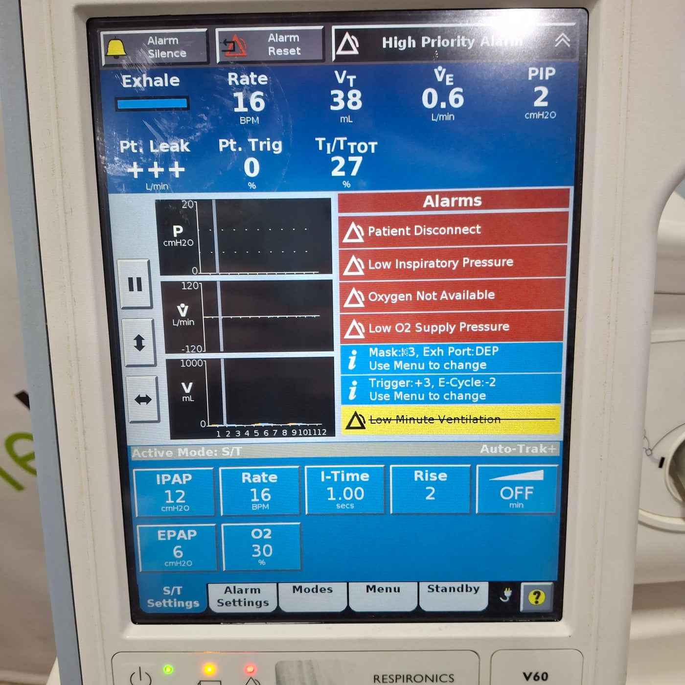 Philips Respironics V60 BiPAP Ventilator