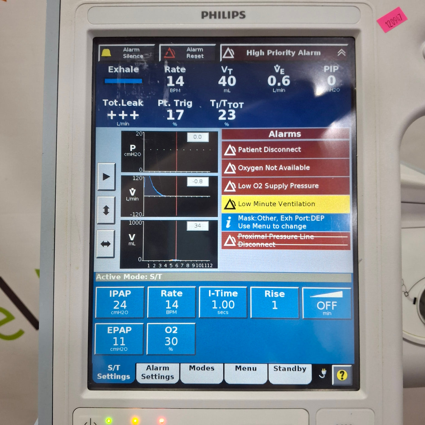 Philips Respironics V60 BiPAP Ventilator